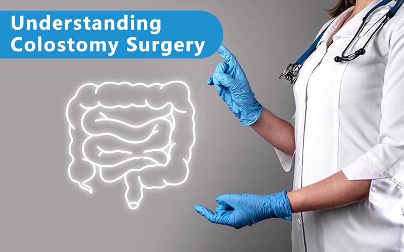 Understanding Colostomy Surgery – HEAGI - Colostomy bags Supplies