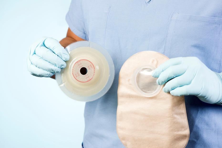 Why is the stoma skin barrier not sticky? – HEAGI - Colostomy bags Supplies